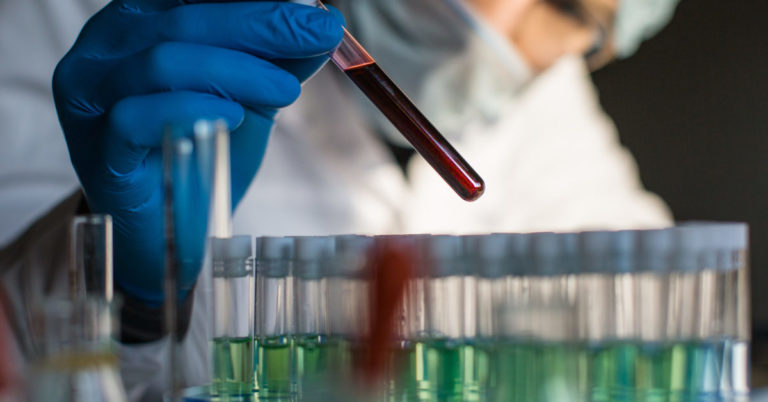 Blood test can detect 50 different types of cancer — Indian Monitor