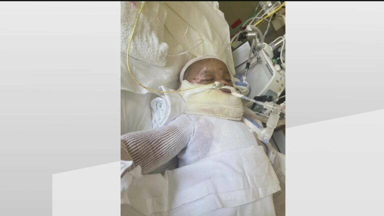 Badly burned victims dragged from fiery wreck after crash into tree at ...
